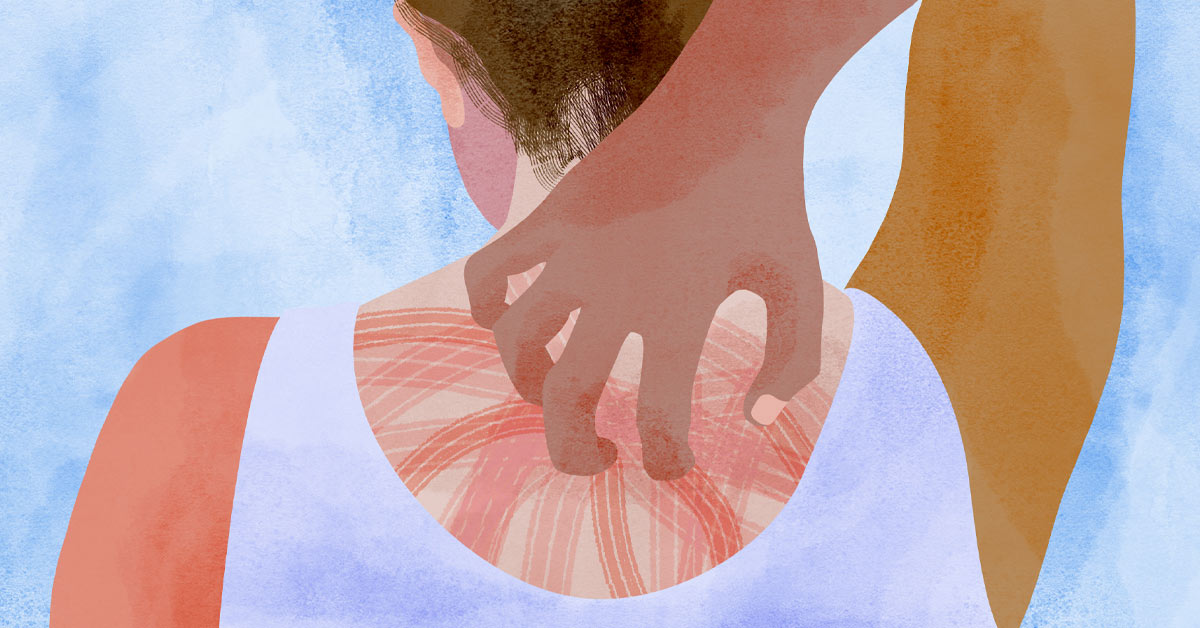 Itching Is a Symptom of NASH